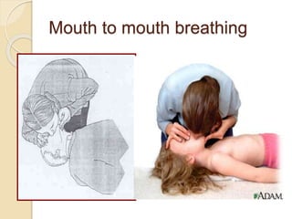 Cardio pulmonary resuscitation (cpr) krl | PPTX