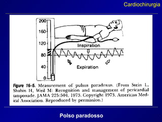 Cardiochirurgia Pericardio | PPT