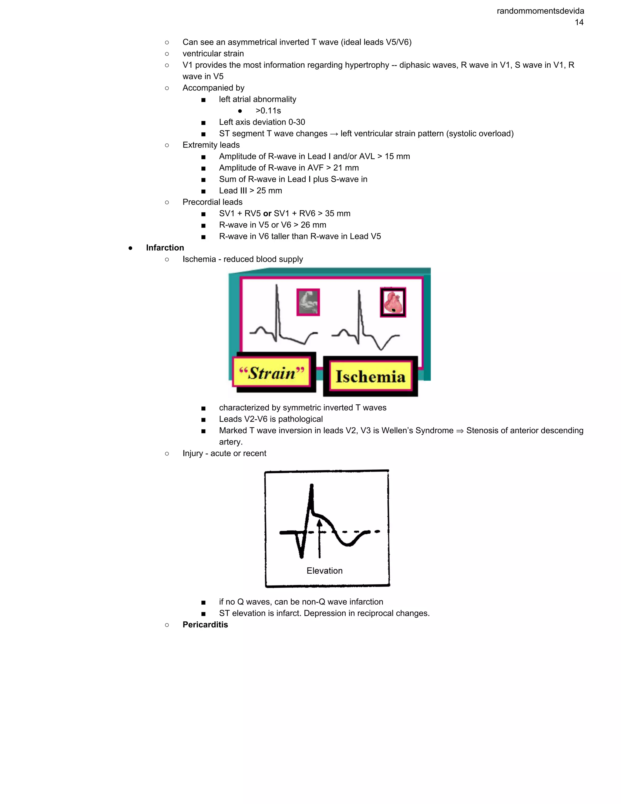 CARDIOLOGY - ECG MADE SIMPLE - HIGH YIELD USMLE | PDF