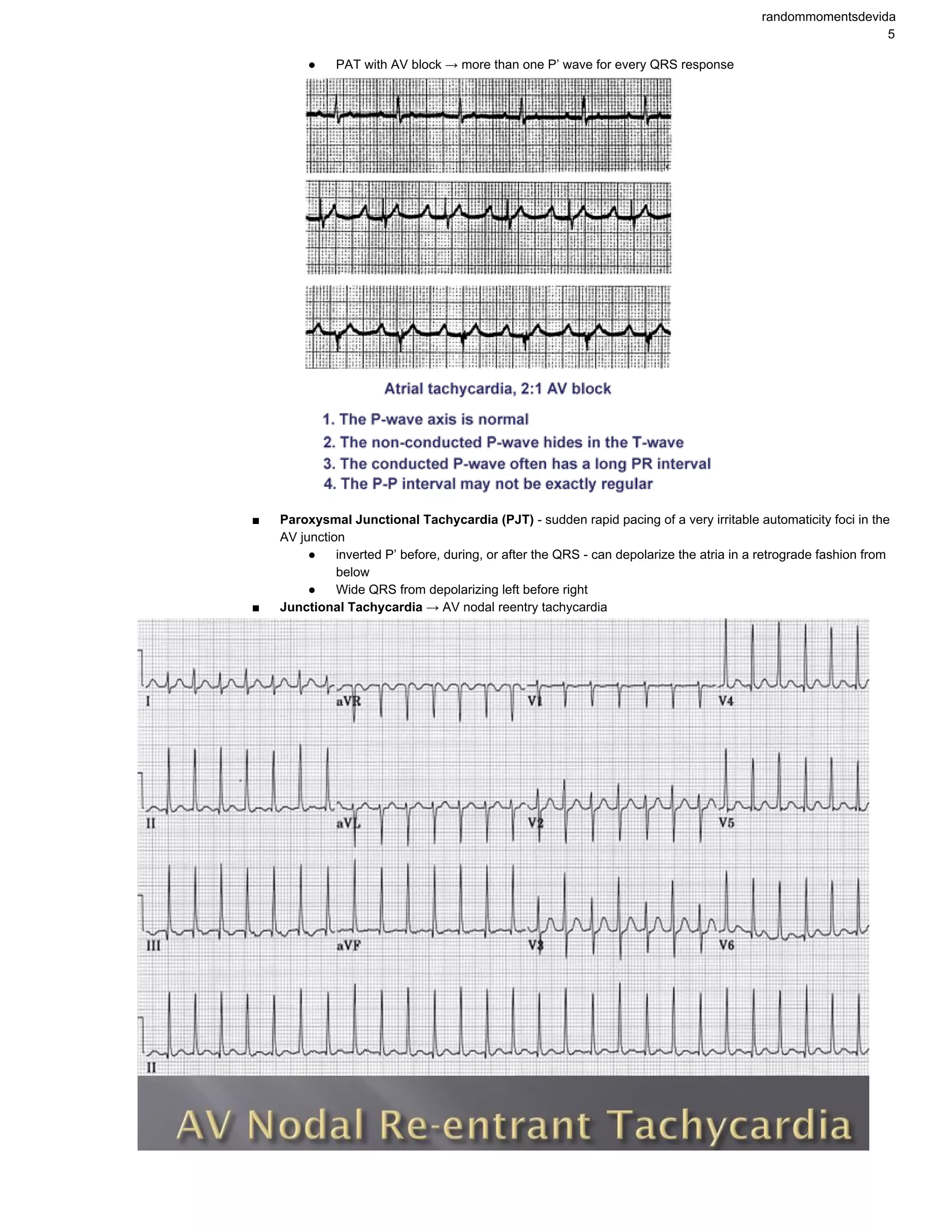 CARDIOLOGY - ECG MADE SIMPLE - HIGH YIELD USMLE | PDF