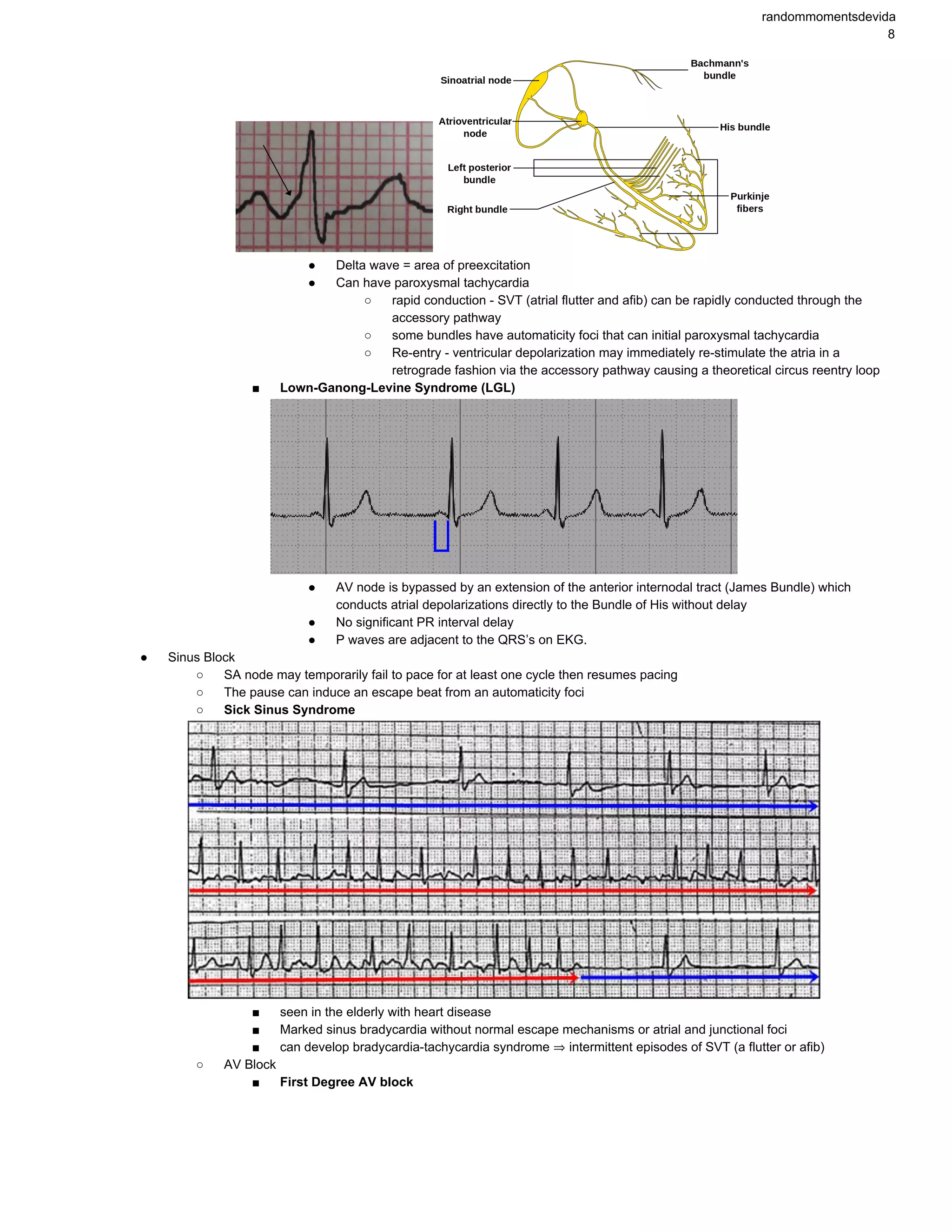 CARDIOLOGY - ECG MADE SIMPLE - HIGH YIELD USMLE | PDF