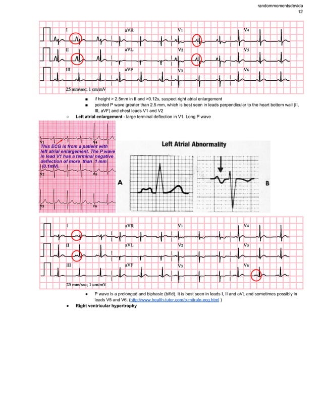 CARDIOLOGY - ECG MADE SIMPLE - HIGH YIELD USMLE | PDF | Heart and ...