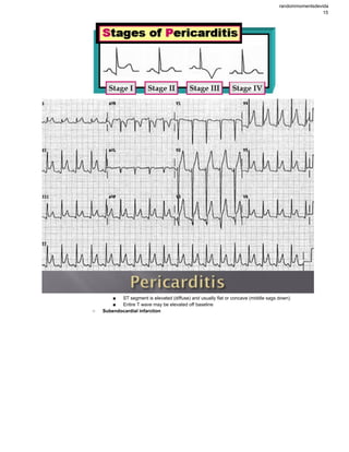CARDIOLOGY - ECG MADE SIMPLE - HIGH YIELD USMLE | PDF