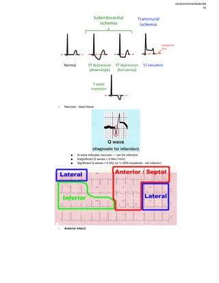 CARDIOLOGY - ECG MADE SIMPLE - HIGH YIELD USMLE | PDF