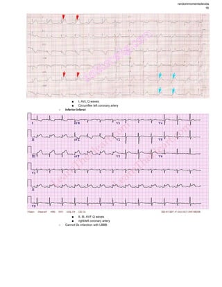 CARDIOLOGY - ECG MADE SIMPLE - HIGH YIELD USMLE | PDF