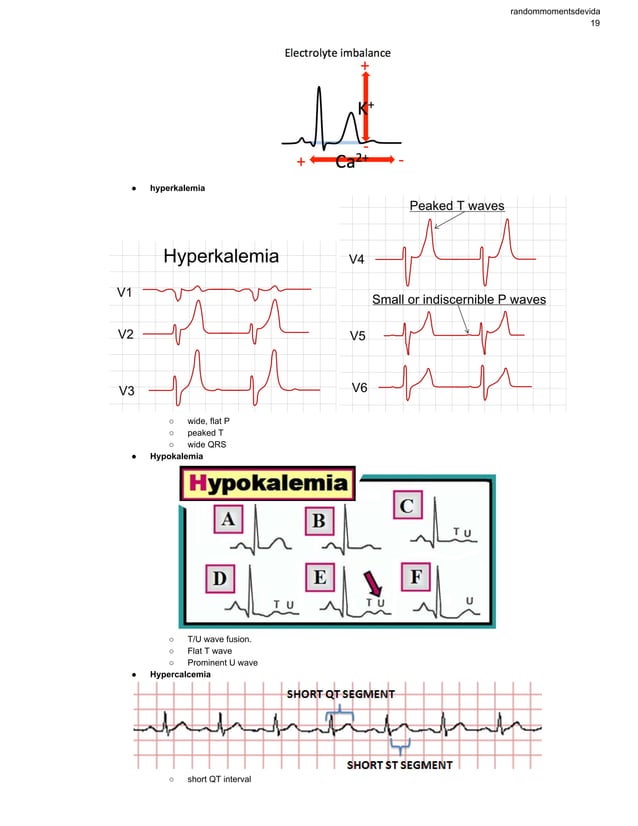 CARDIOLOGY - ECG MADE SIMPLE - HIGH YIELD USMLE | PDF | Heart and ...