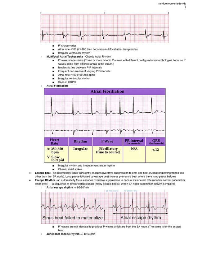 CARDIOLOGY - ECG MADE SIMPLE - HIGH YIELD USMLE | PDF | Heart and ...