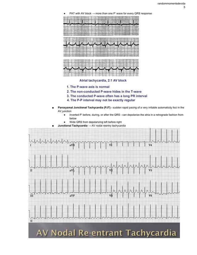 CARDIOLOGY - ECG MADE SIMPLE - HIGH YIELD USMLE | PDF | Heart and ...