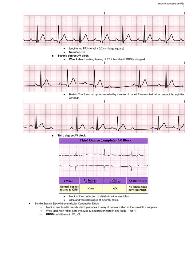 CARDIOLOGY - ECG MADE SIMPLE - HIGH YIELD USMLE | PDF | Heart and ...