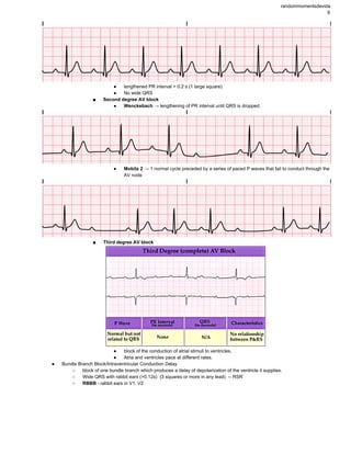 EKG Examples Free Download As PDF File Text File Or Read , 43% OFF