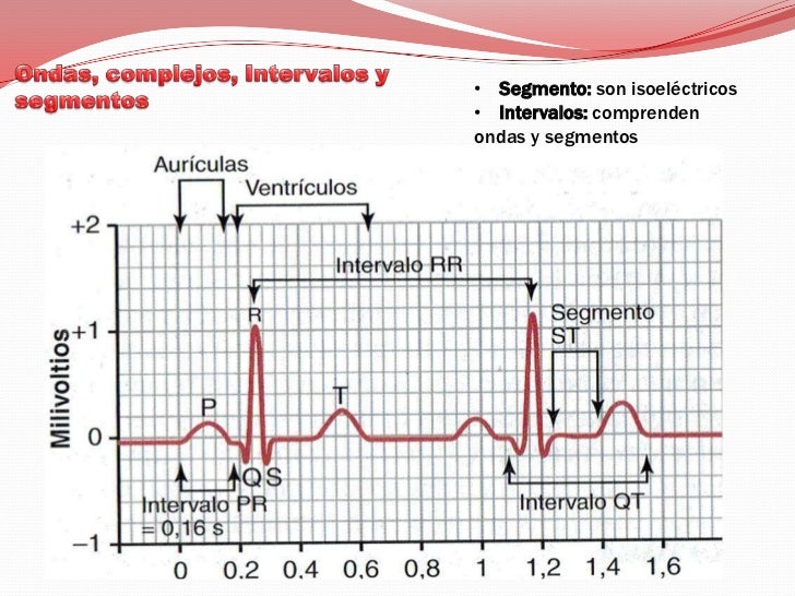 ECG NORMAL Y EJE ELECTRICO