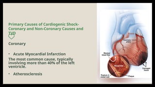 Cardiogenic Shock Critical-Review 1.pptx
