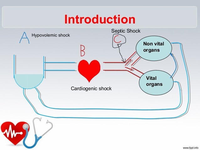 Cardiogenic shock