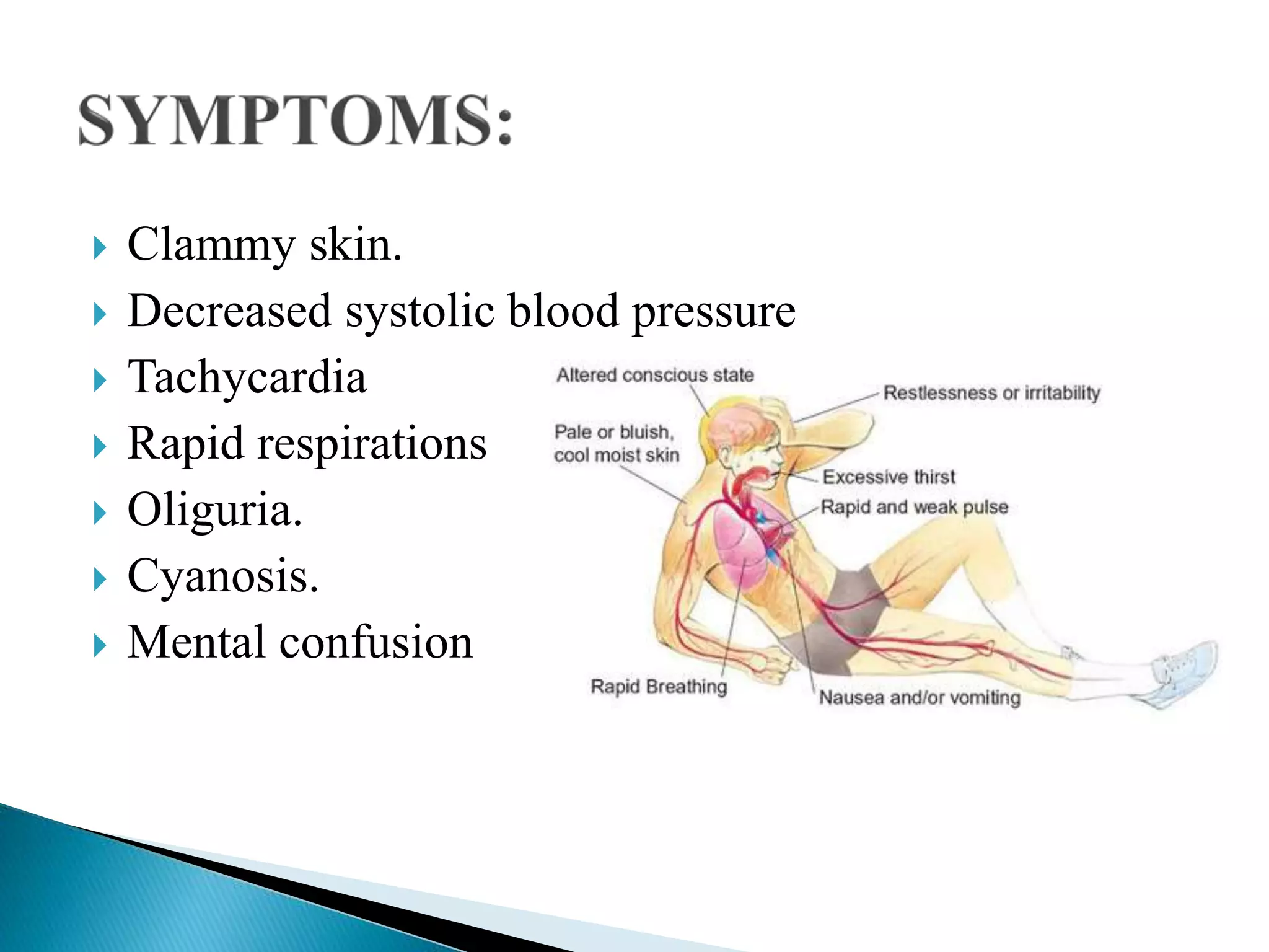 Cardiogenic shock | PPTX