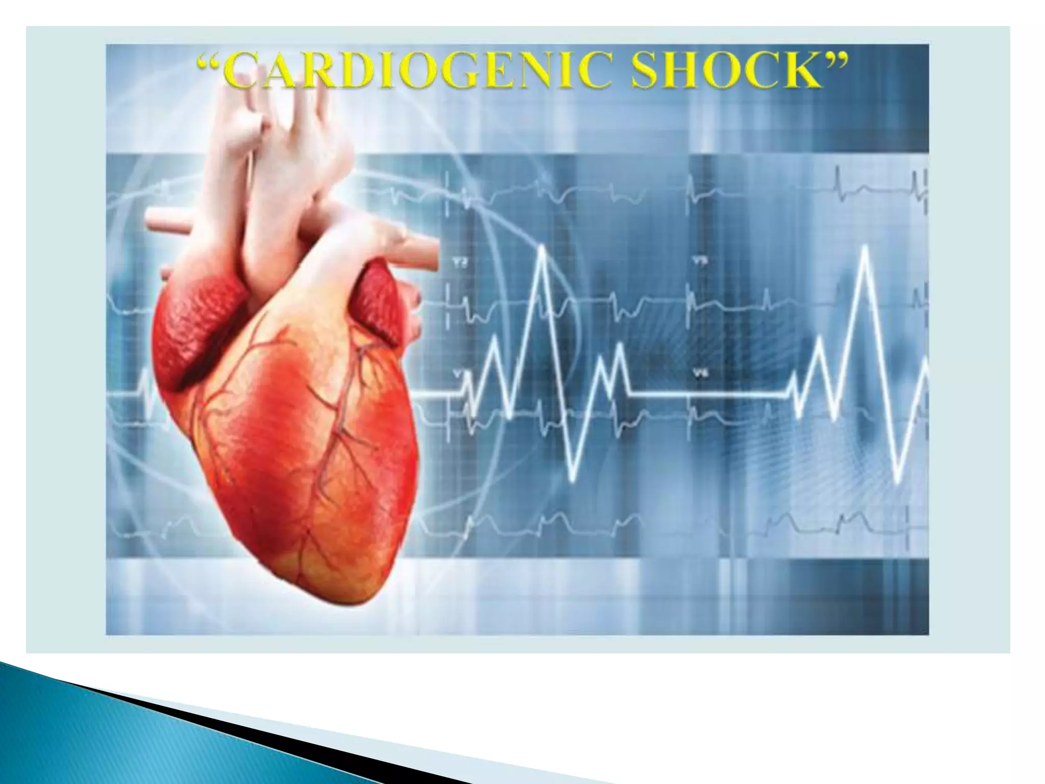 Cardiogenic shock | PPTX