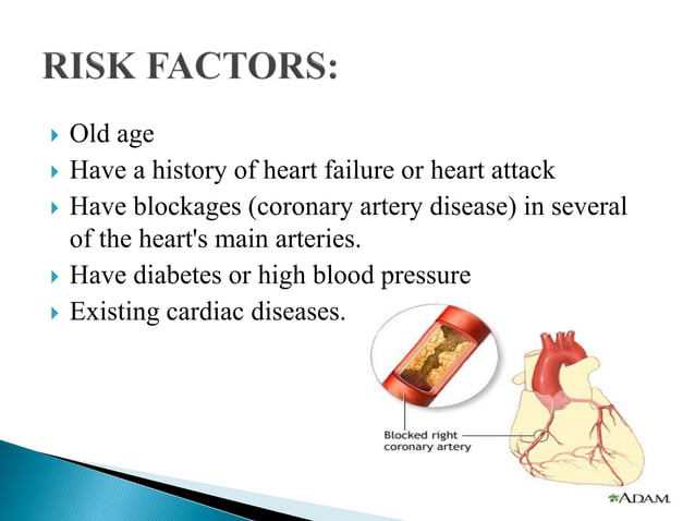 Cardiogenic shock | PPTX