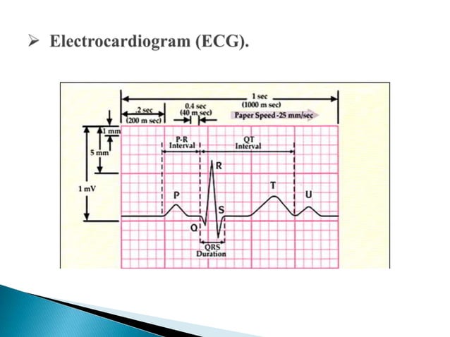 Cardiogenic shock | PPTX