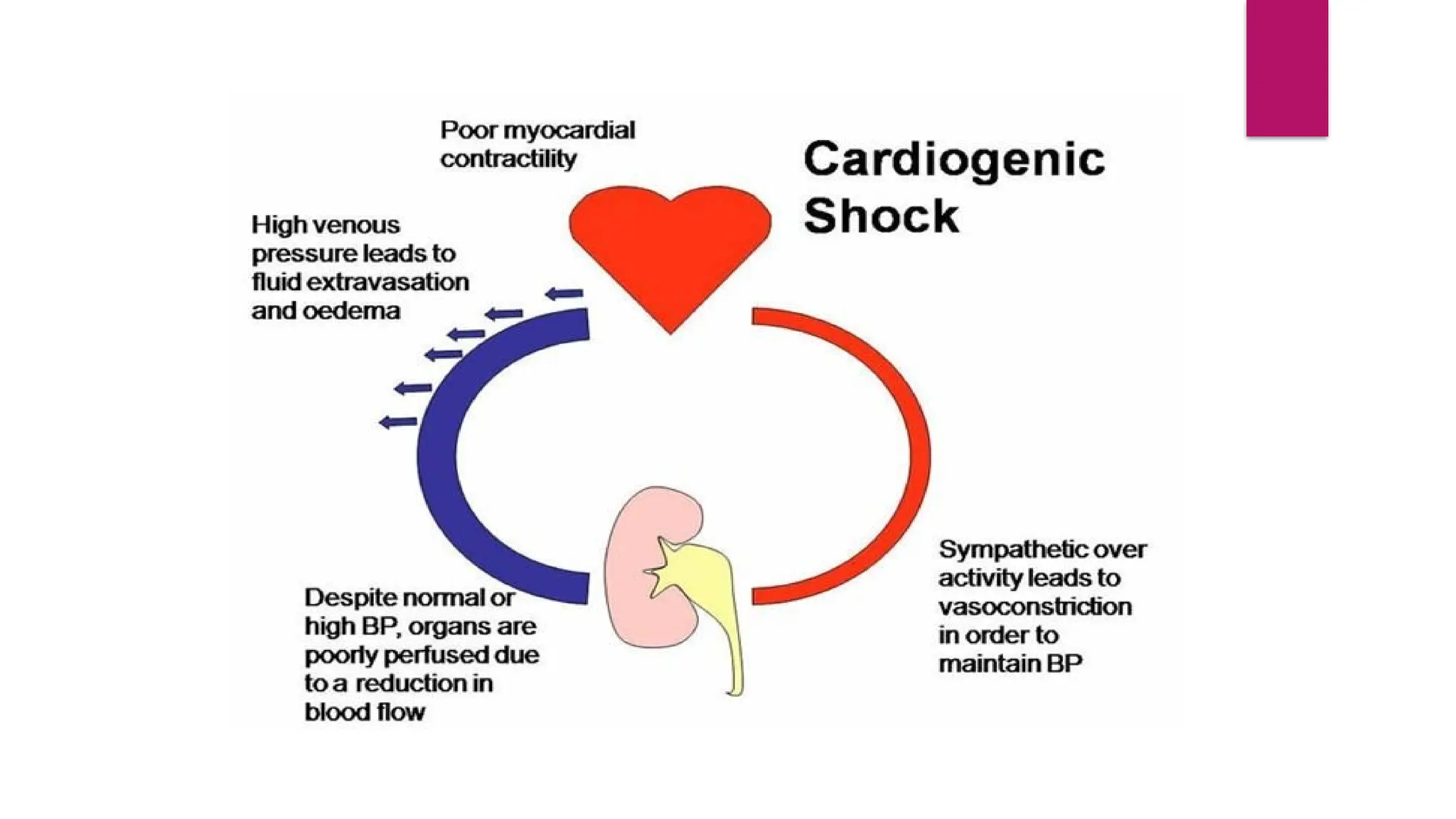 * Cardiogenic Shock - PowerPoint Presentation. | PPTX