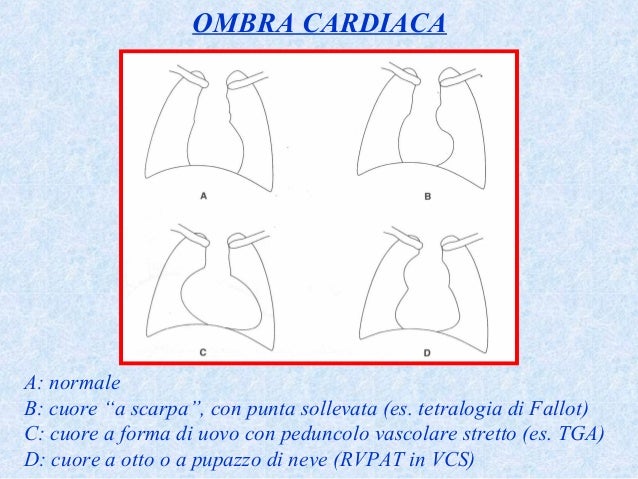 Cardiologia pediatrica infermieri