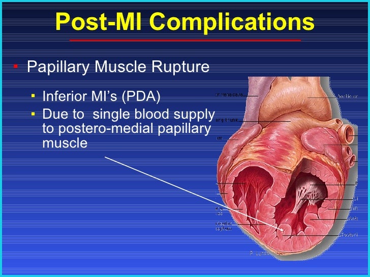 Cardiology Board Review 2008