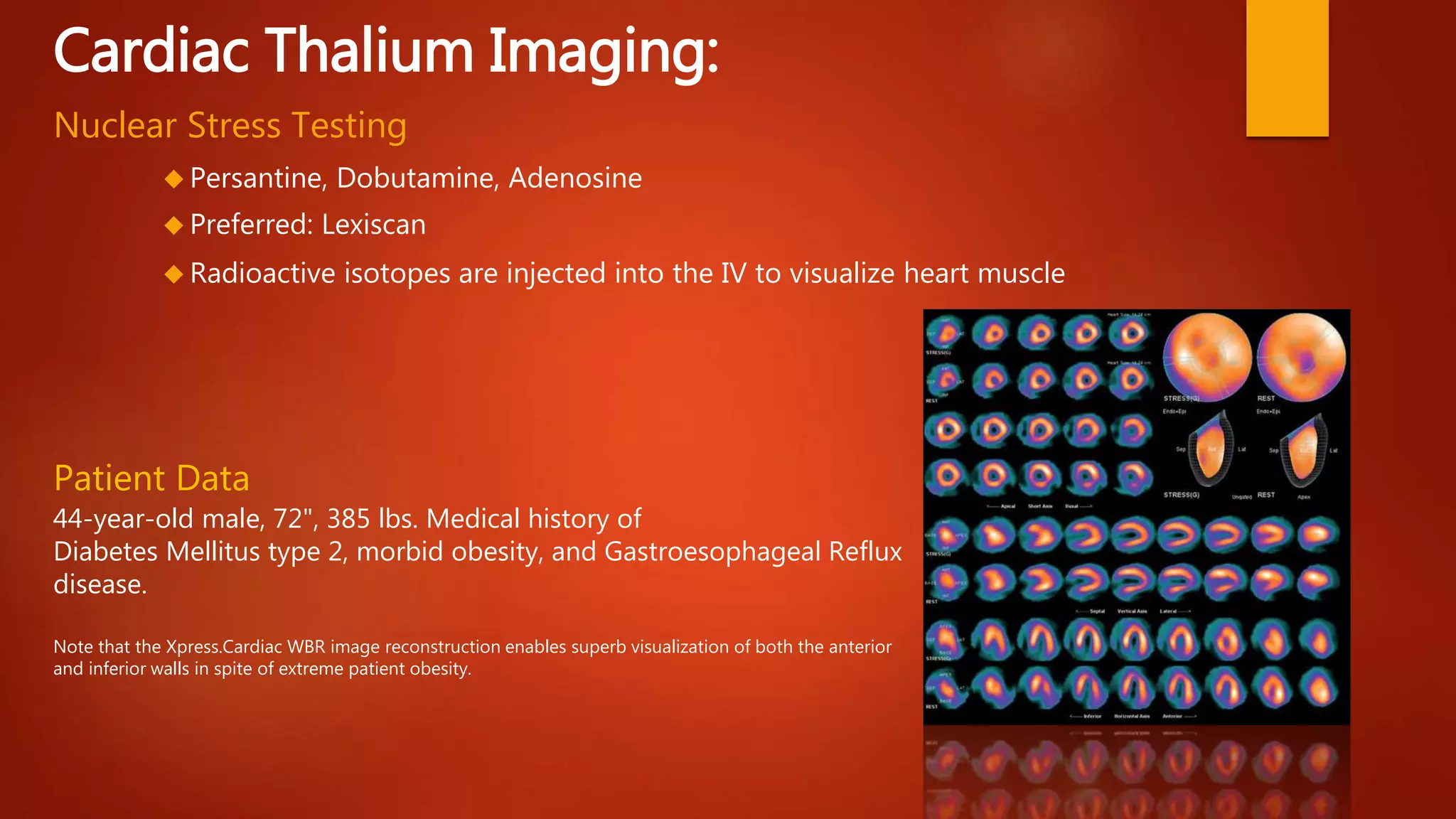 Cardiology 101 back to the basics | PPTX