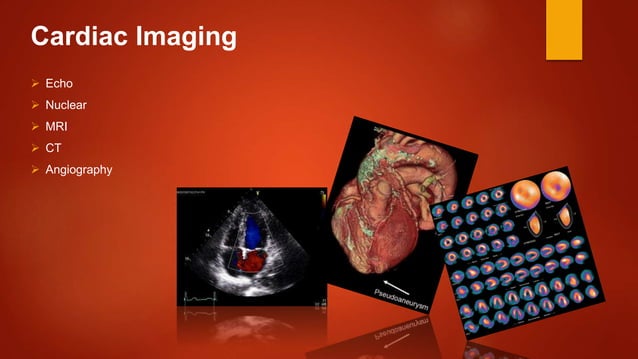 Cardiology 101 back to the basics