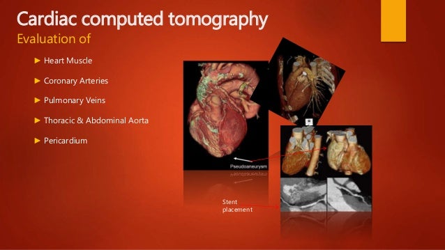 Cardiology 101 back to the basics