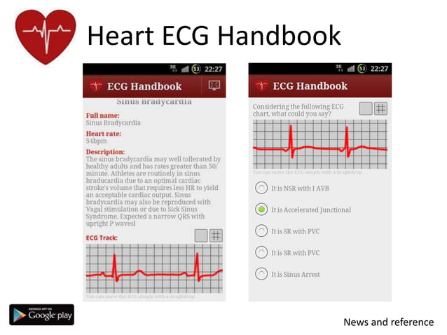 Cardiology apps 2013 | PPTX | Heart and Cardiovascular Diseases ...
