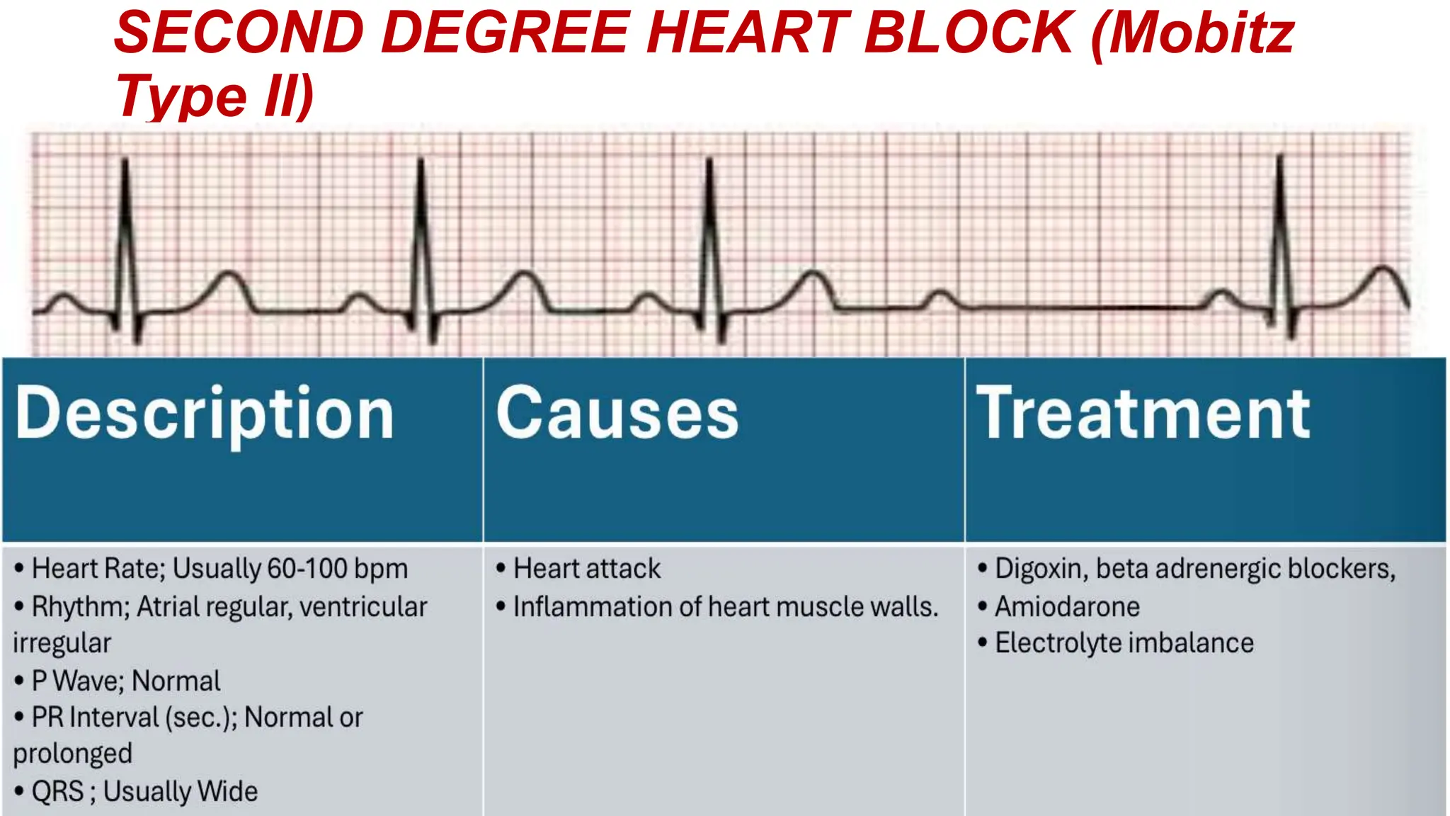 Arrhythmias (Cardiology /Cardiovascular) .pptx