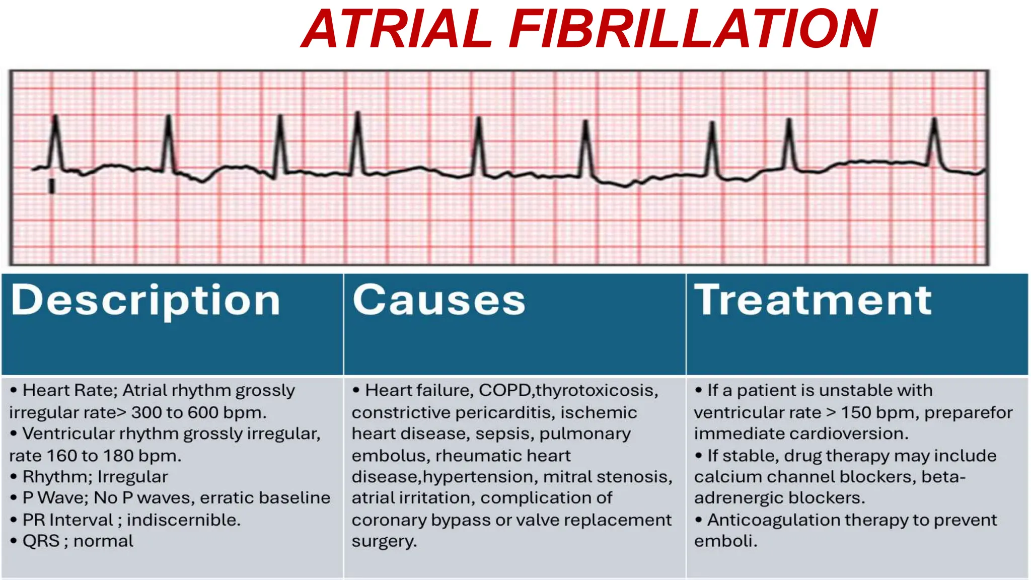 Arrhythmias (Cardiology /Cardiovascular) .pptx