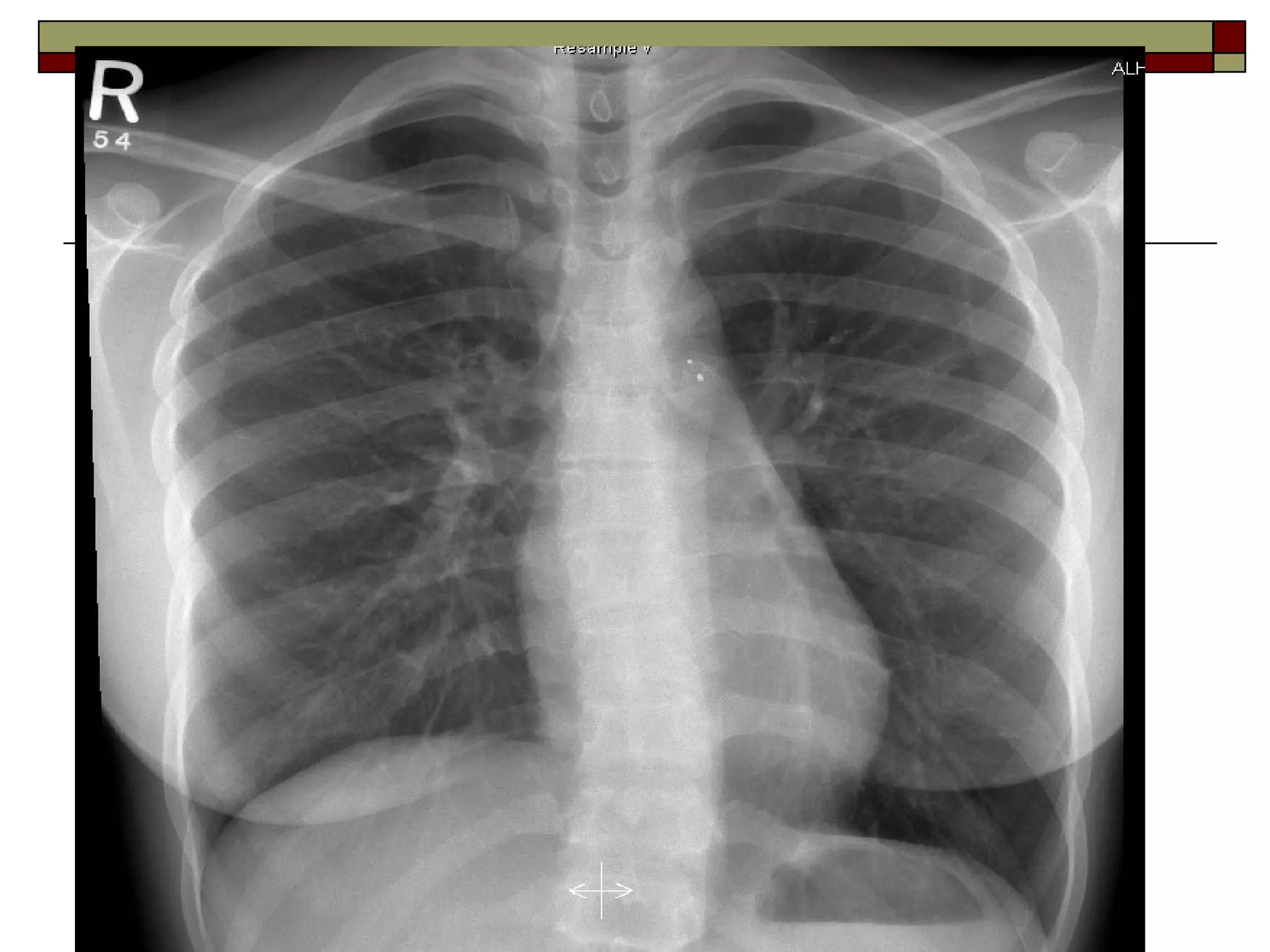 Cardiology board images | PPT