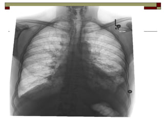 Cardiology board images | PPT