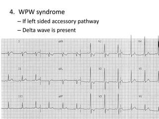 Cardiology case 1 | PPTX
