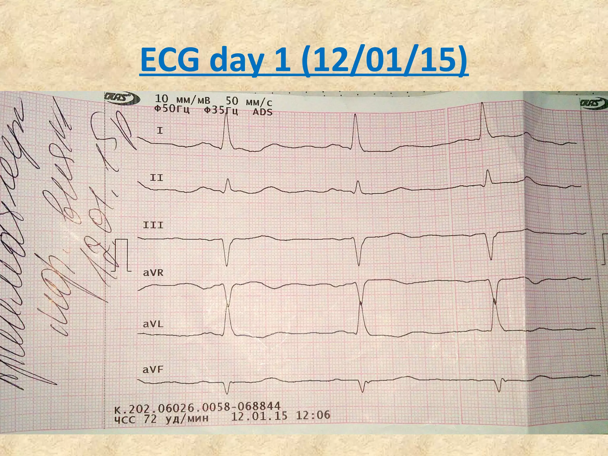 Cardiology case report...an example | PPT