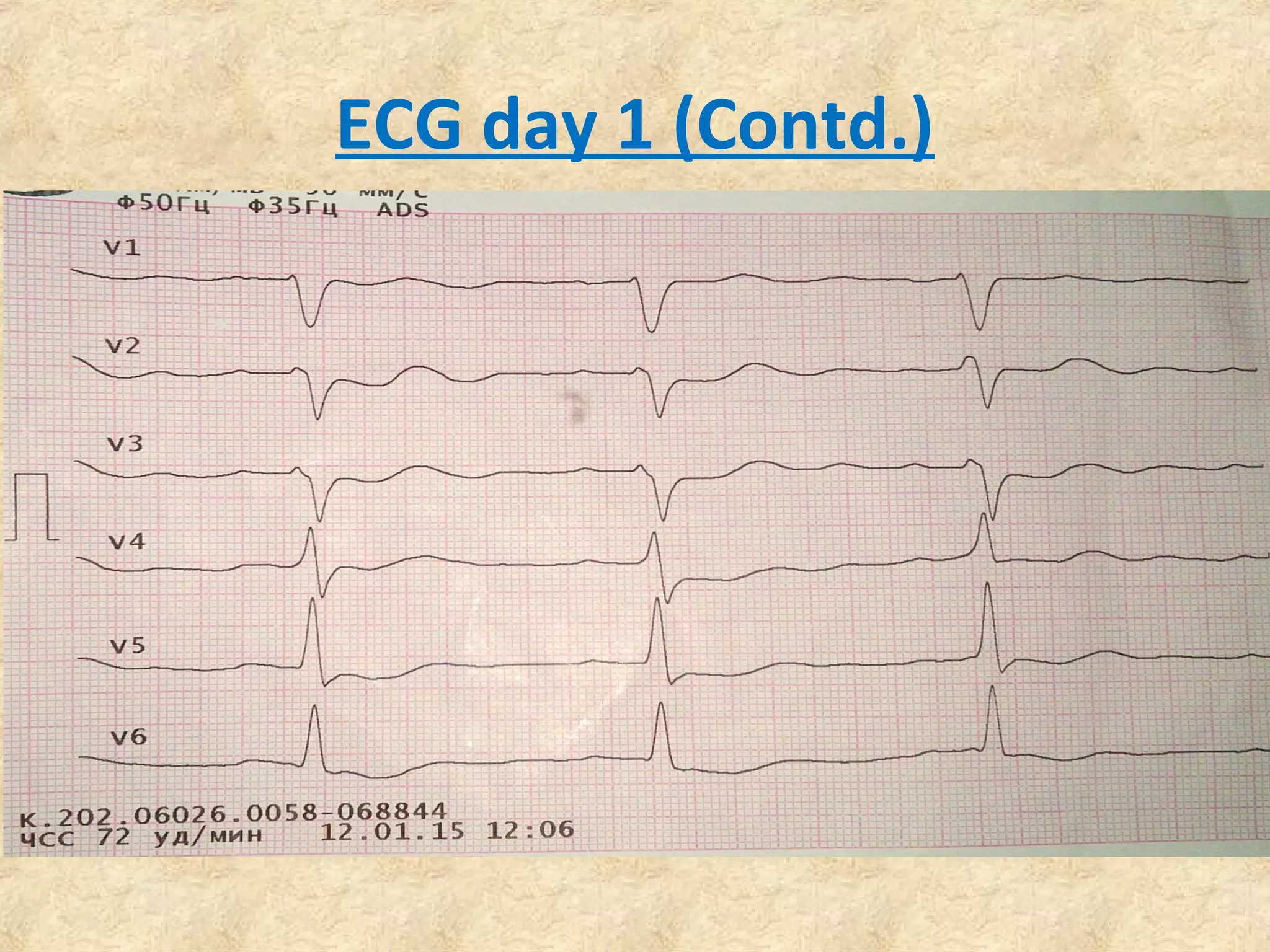 Cardiology case report...an example | PPT