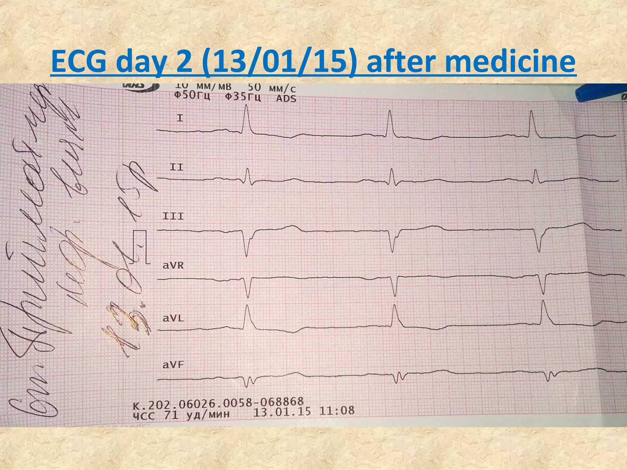 Cardiology case report...an example | PPT