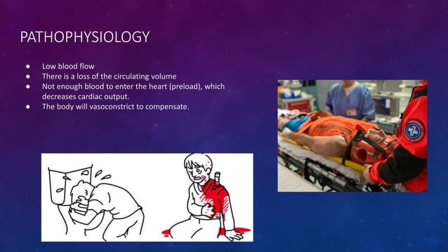 Cardiology and EKGs - Archer NCLEX crash course/ webinar | PPTX | Heart ...
