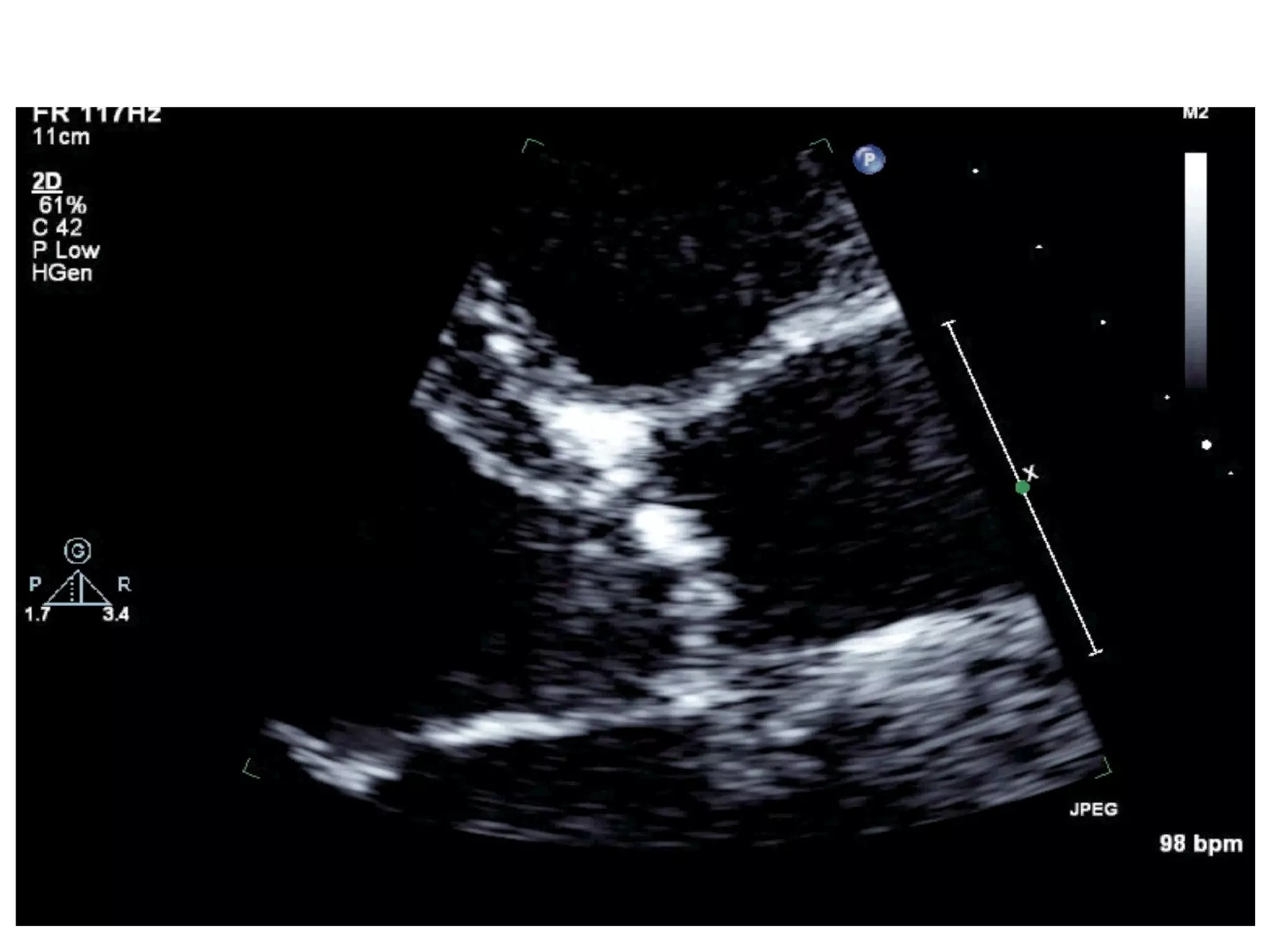 Cardiology morning presentation 2 im1962012 | PPT | Heart and ...