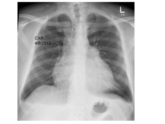 Cardiology morning presentation 2 im1962012 | PPT | Heart and ...