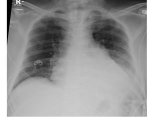 Cardiology morning presentation 2 im1962012 | PPT | Heart and ...