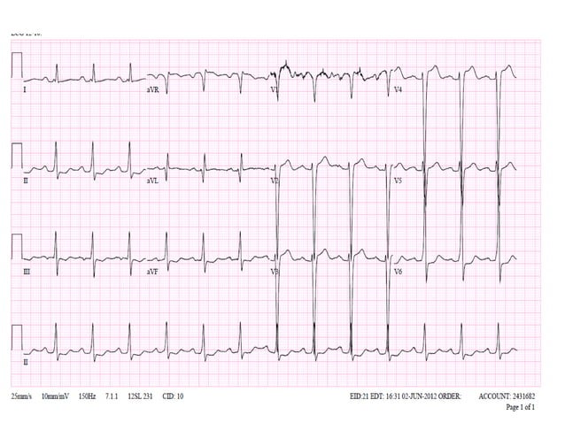 Cardiology morning presentation 2 im1962012 | PPT | Heart and ...