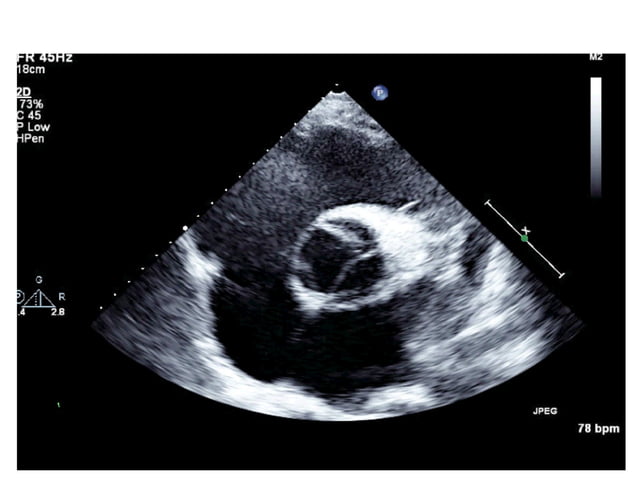 Cardiology morning presentation 2 im1962012 | PPT | Heart and ...