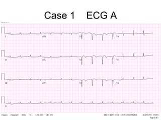 Cardiology morning presentation 2 im1962012 | PPT | Heart and ...