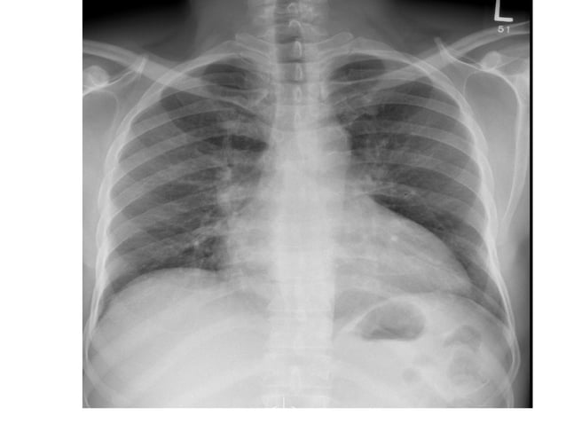 Cardiology morning presentation 2 im1962012 | PPT | Heart and ...