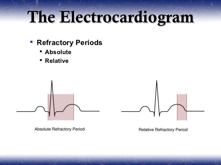 Refractory Period On Ecg