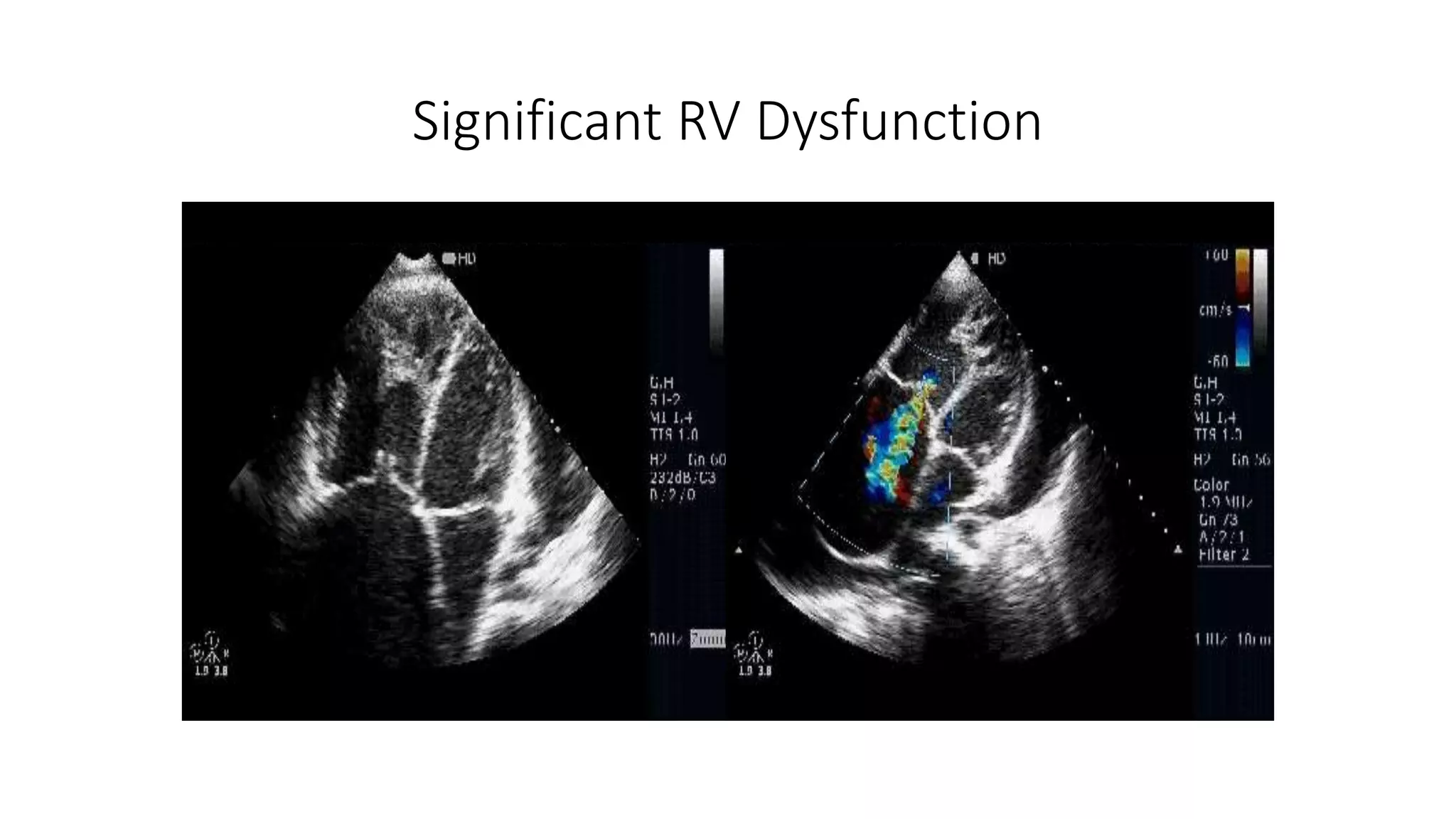 CARDIOLOGY SPOTTER 1111111.pptx