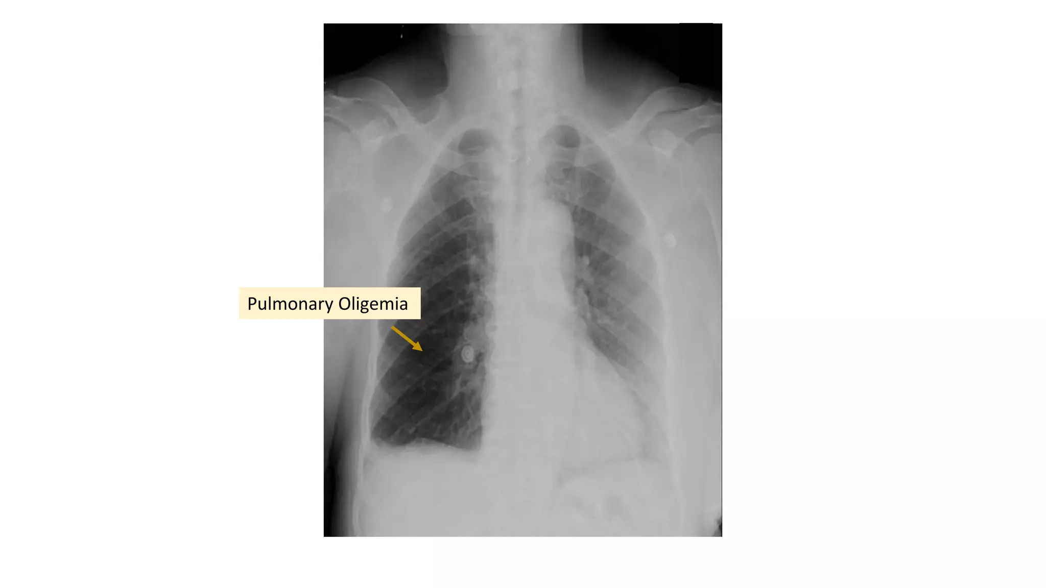 CARDIOLOGY SPOTTER 1111111.pptx