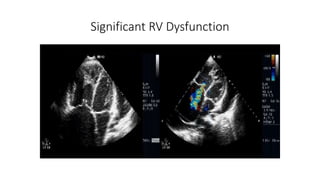 CARDIOLOGY SPOTTER 1111111.pptx | Heart and Cardiovascular Diseases ...