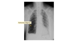 CARDIOLOGY SPOTTER 1111111.pptx | Heart and Cardiovascular Diseases ...