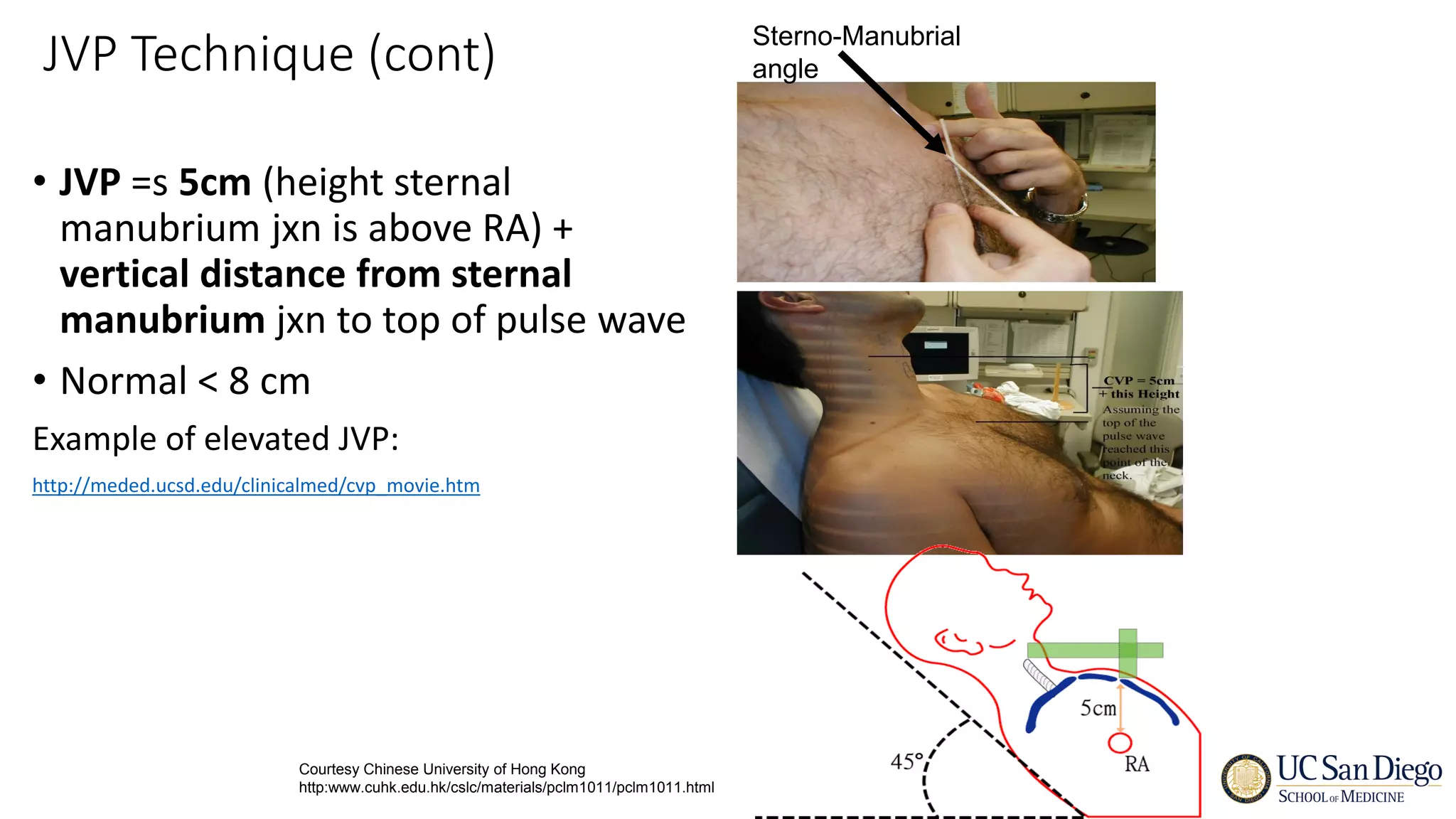 Cardiolovascular Exam.pdf